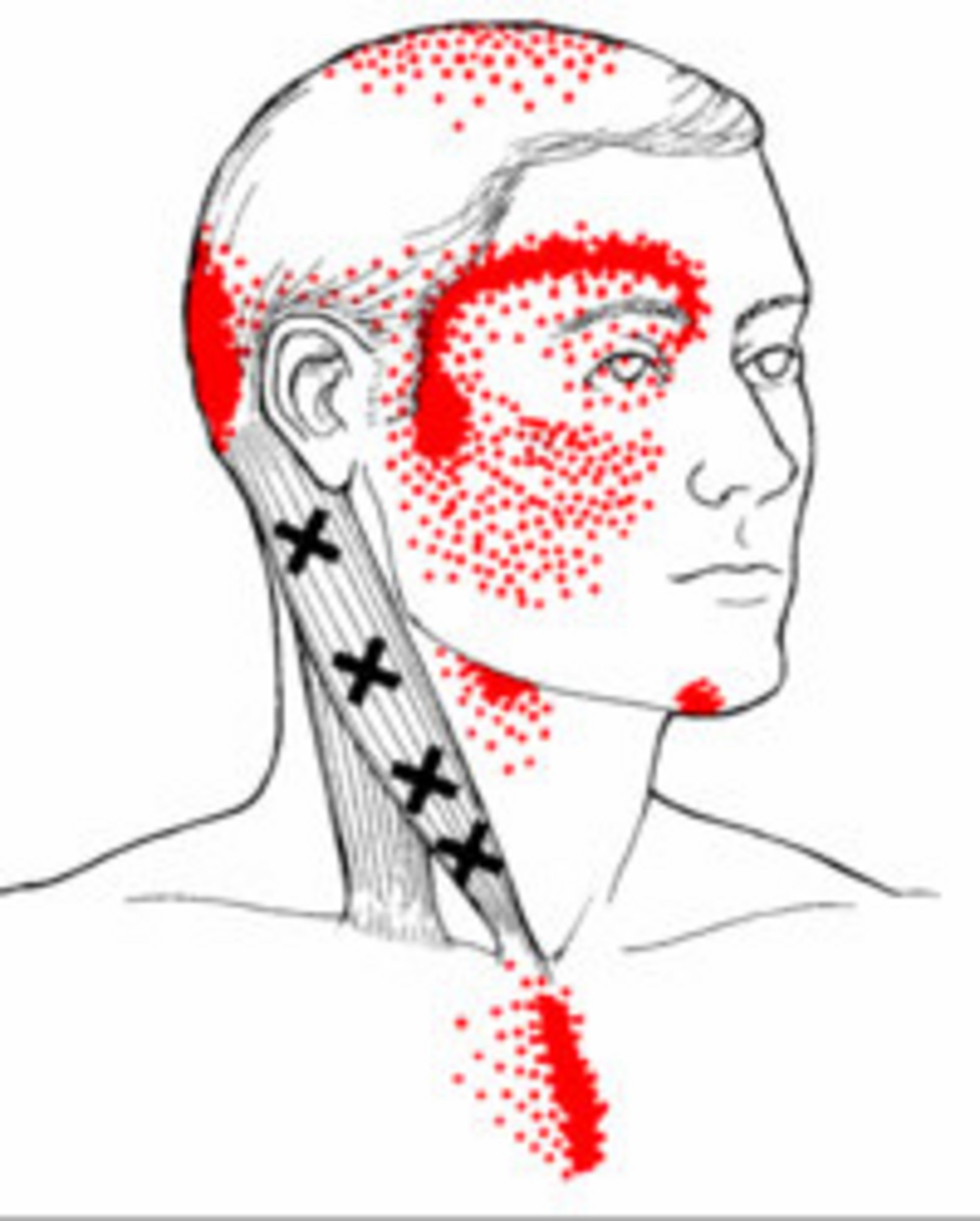 Triggerpunkttherapie - Ordination mit Herz